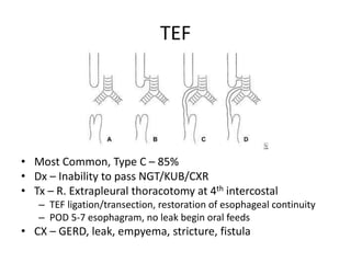 Pediatric surgery ABSITE | PPTX