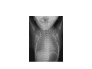 Pediatric surgery ABSITE | PPTX