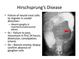 Pediatric surgery ABSITE | PPTX
