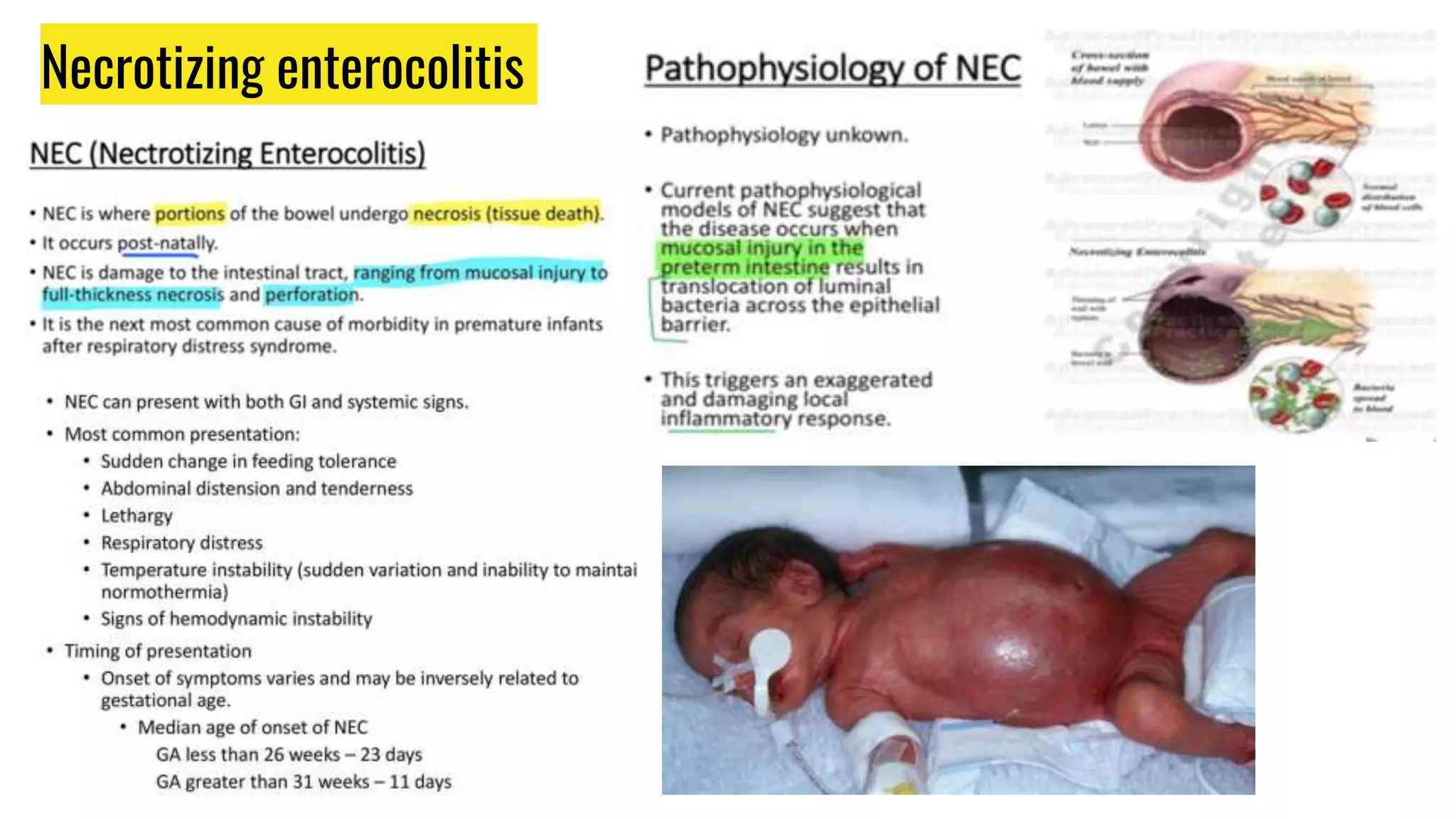 Pediatric surgery Gi abnormalities.pptx