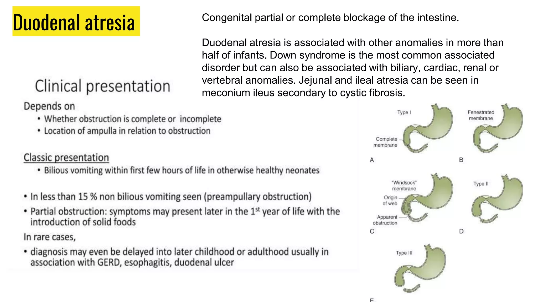 Pediatric surgery Gi abnormalities.pptx