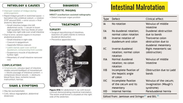 Pediatric surgery Gi abnormalities.pptx