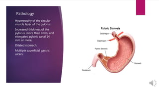 Pediatric surgery ppt 6th year | PPT