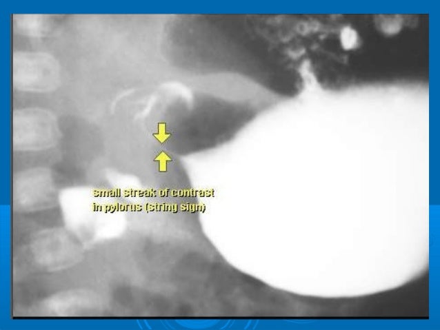 Pediatric Surgery Review
