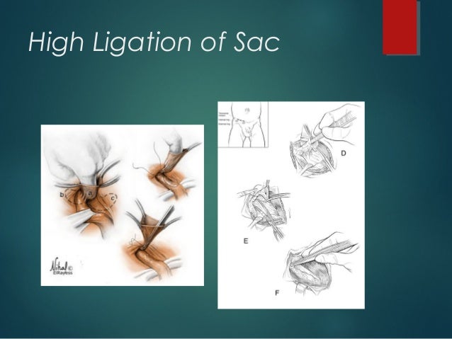 Pediatric surgical emergencies