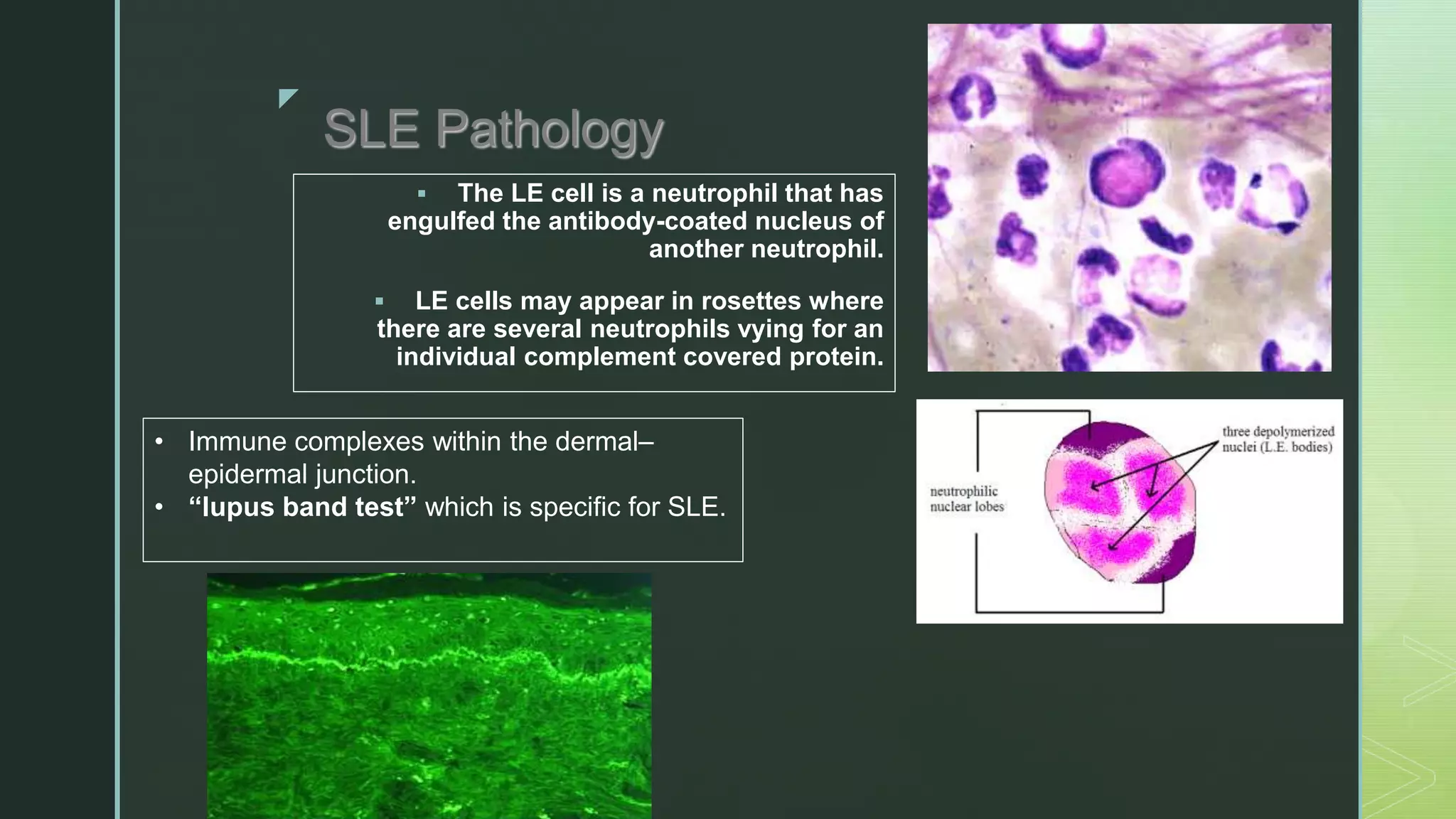 Pediatric systemic lupus erythematosus | PPTX