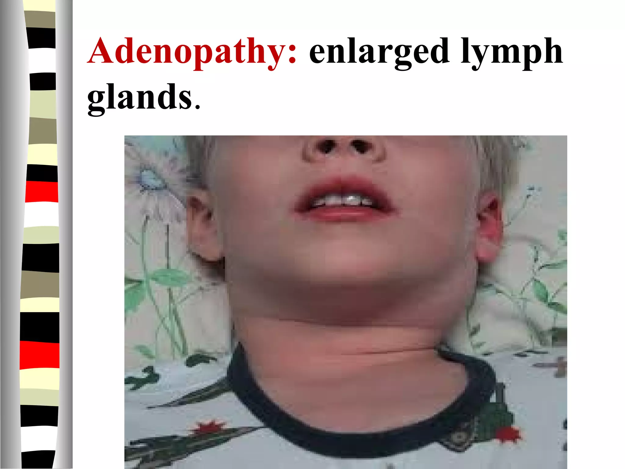 Pediatric terminology | PPT