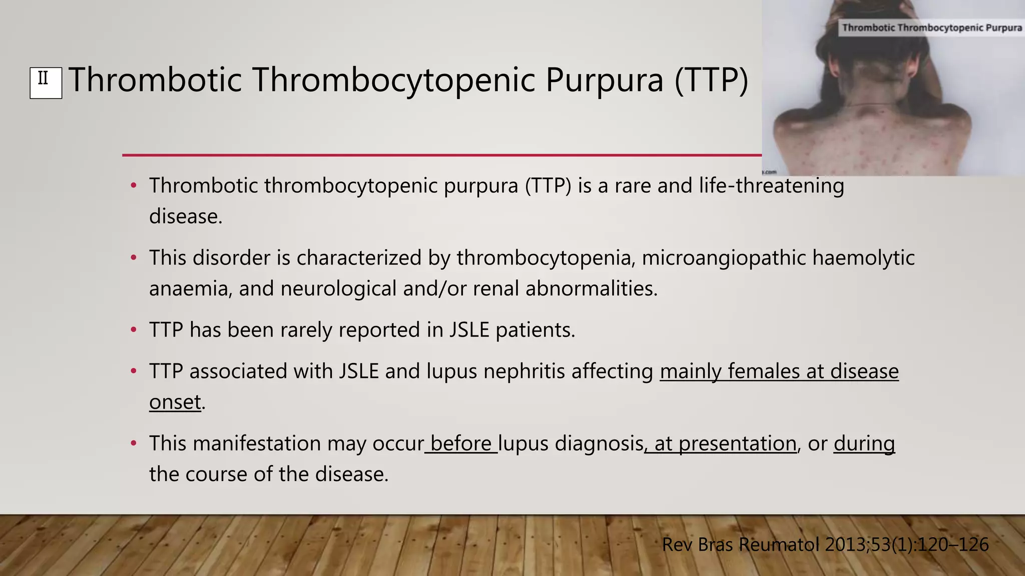Pediatric thrombocytopenia | PPTX