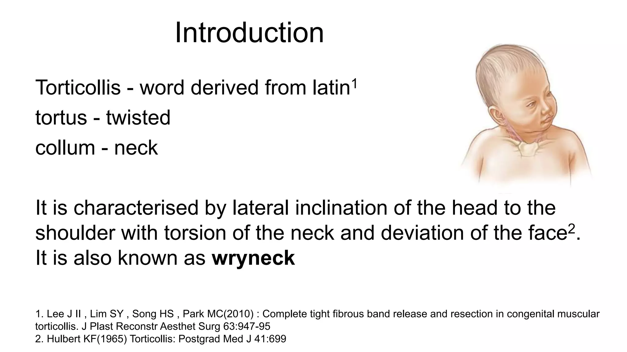 Pediatric torticollis | PPTX