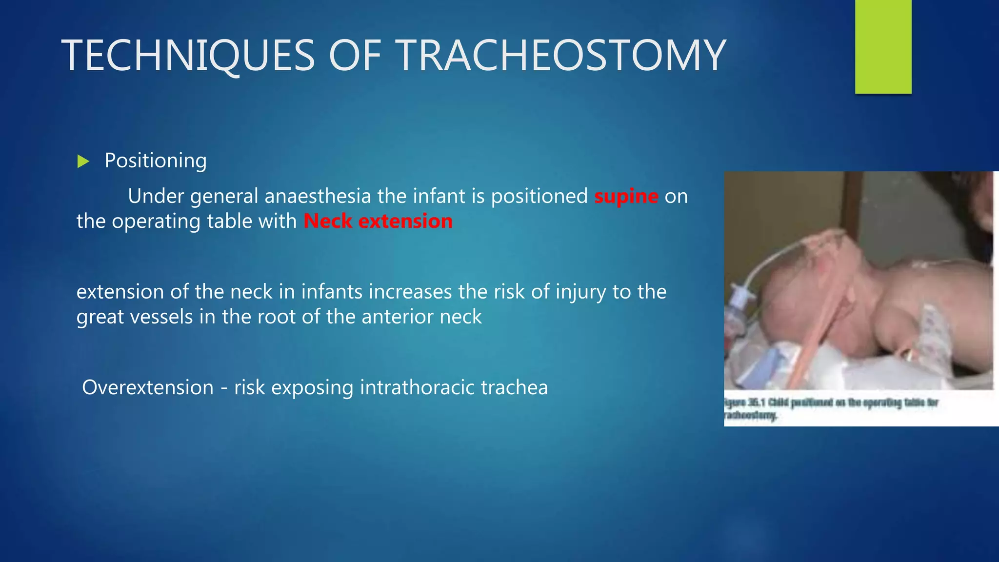 Pediatric trachostomy | PPTX