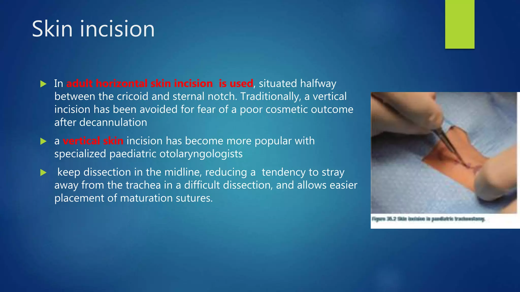 Pediatric trachostomy | PPTX
