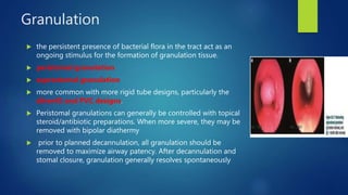 Pediatric trachostomy | PPTX