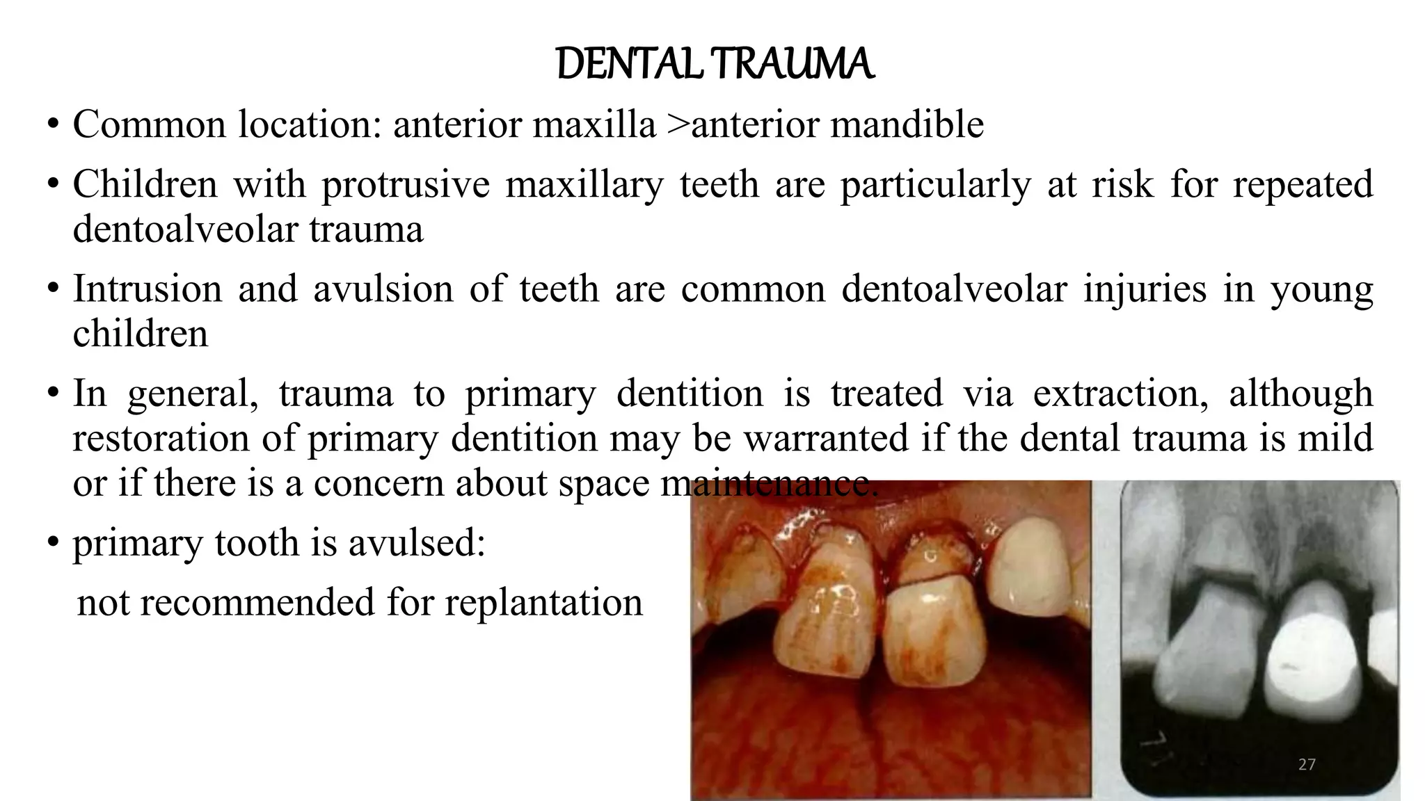 Pediatric trauma | PPTX