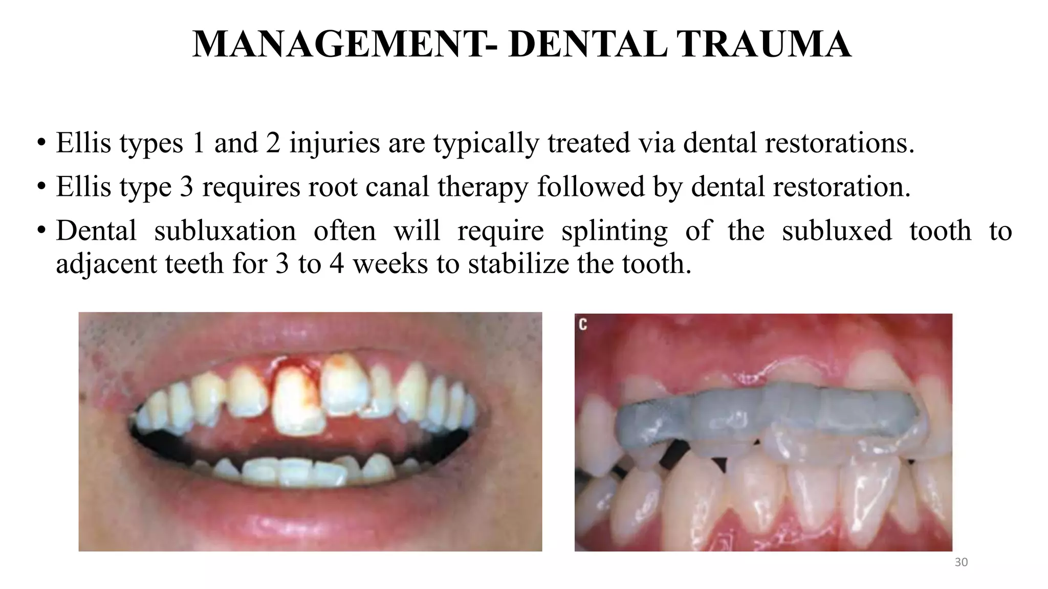 Pediatric trauma | PPTX