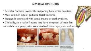 Pediatric trauma | PPTX