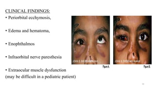 Pediatric trauma | PPTX