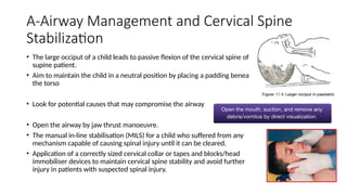 Pediatric trauma in emergency (presentation) | PPTX