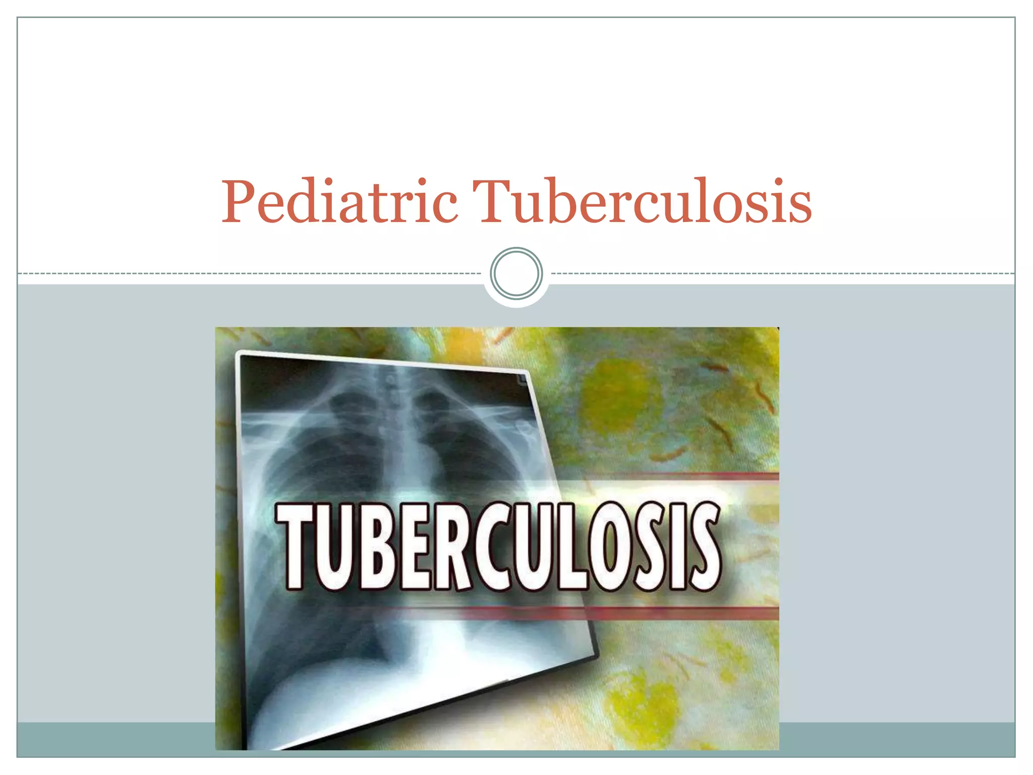 Pediatric tuberculosis | PPTX