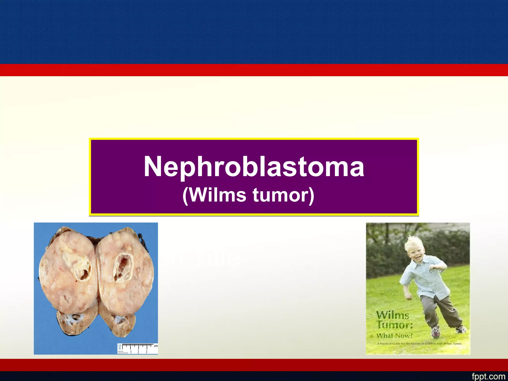 Common Pediatric Solid Tumors | PPT
