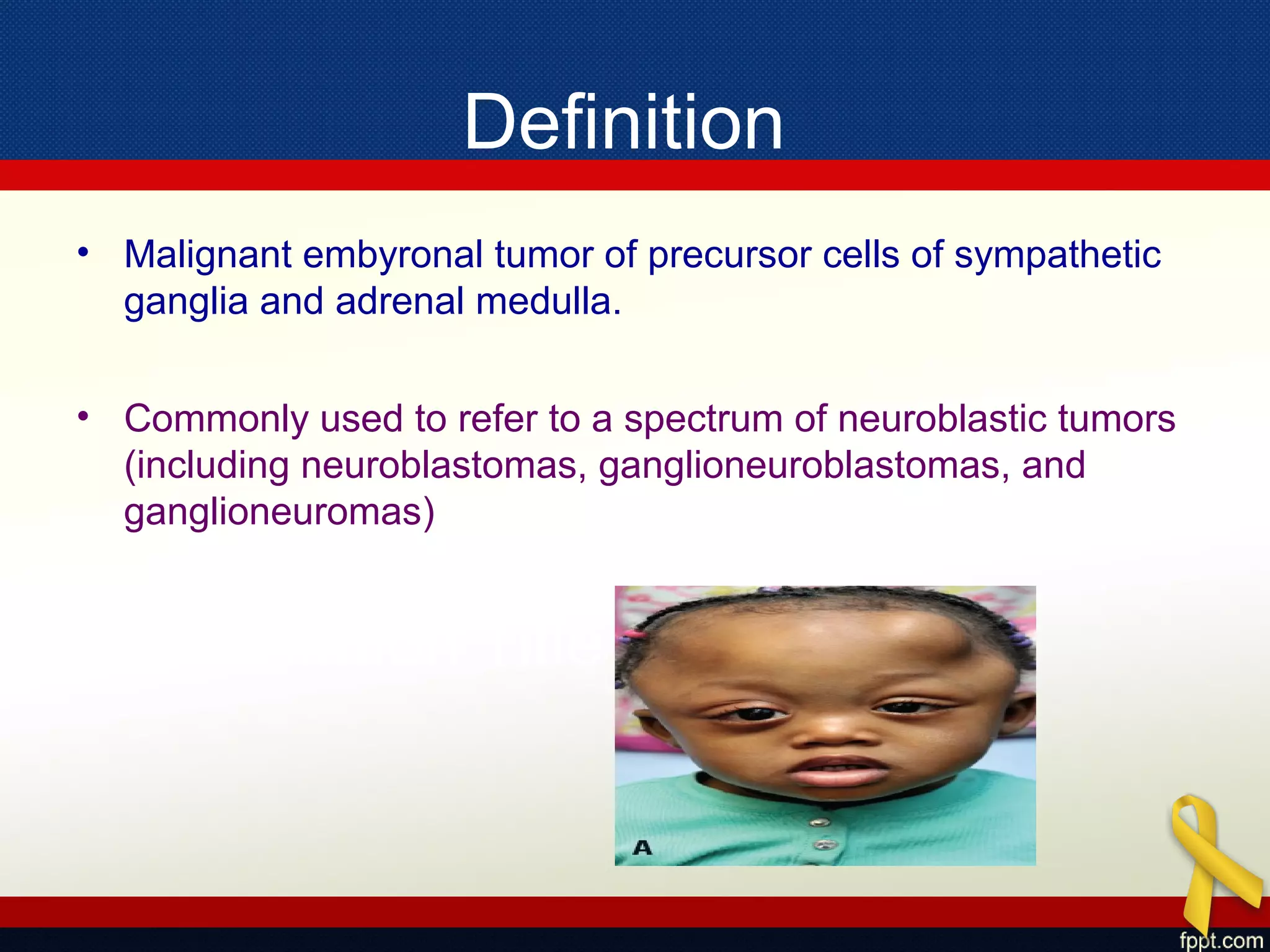 Common Pediatric Solid Tumors | PPT
