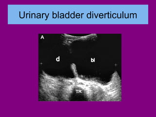 Pediatric urinary tract infection..the role of imaging | PPT