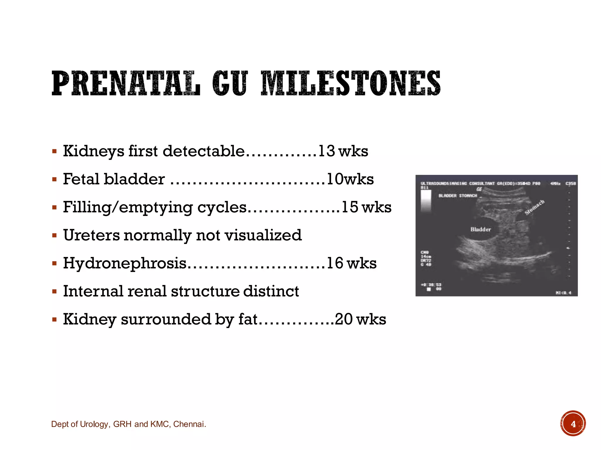 Pediatric urology Management Of Antenatal Hydroureteronephrosis | PDF