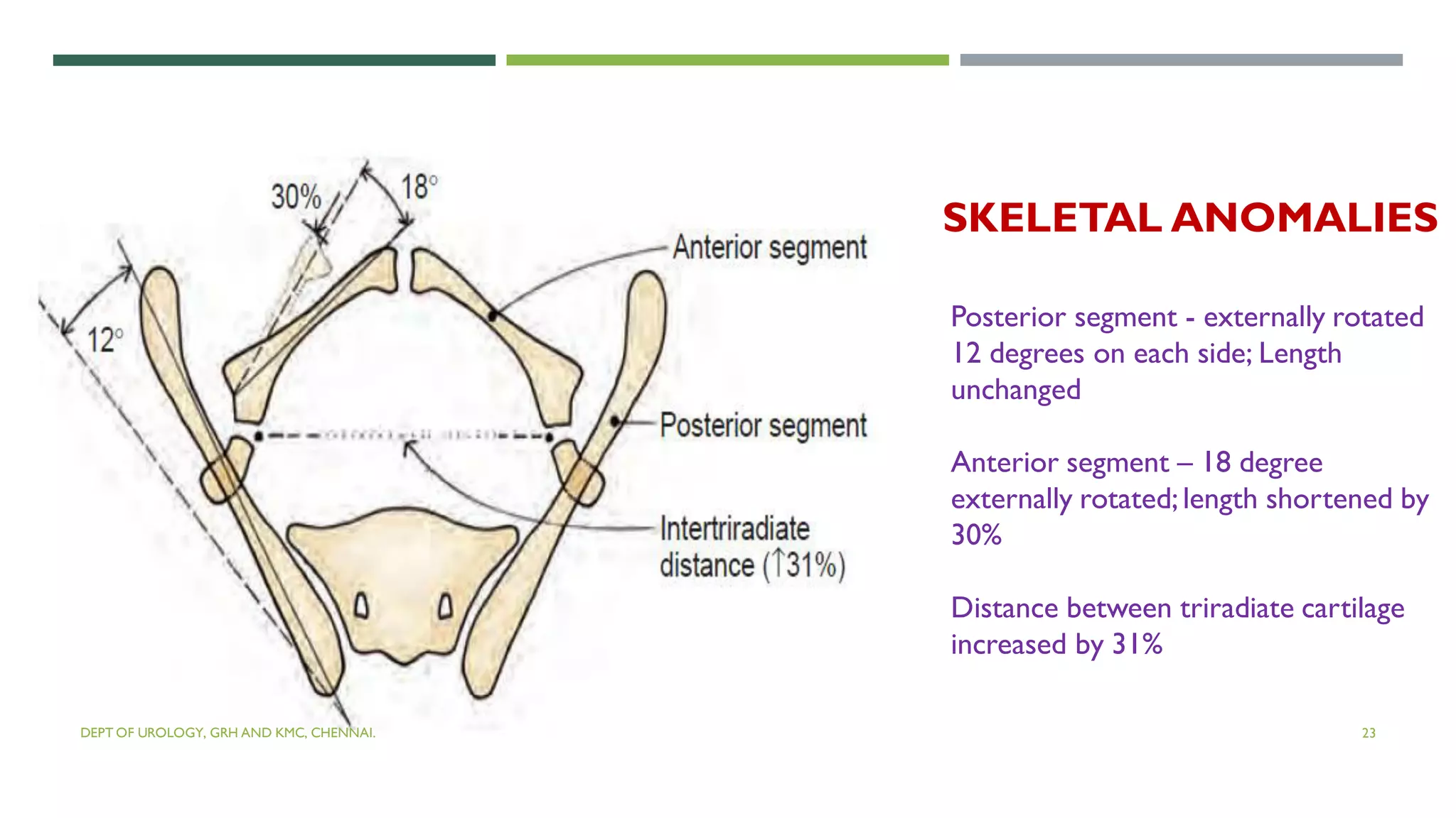 Pediatric urology:Bladder extrophy and Epispadias complex | PDF