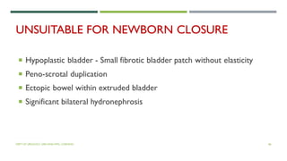 Pediatric urology:Bladder extrophy and Epispadias complex | PDF