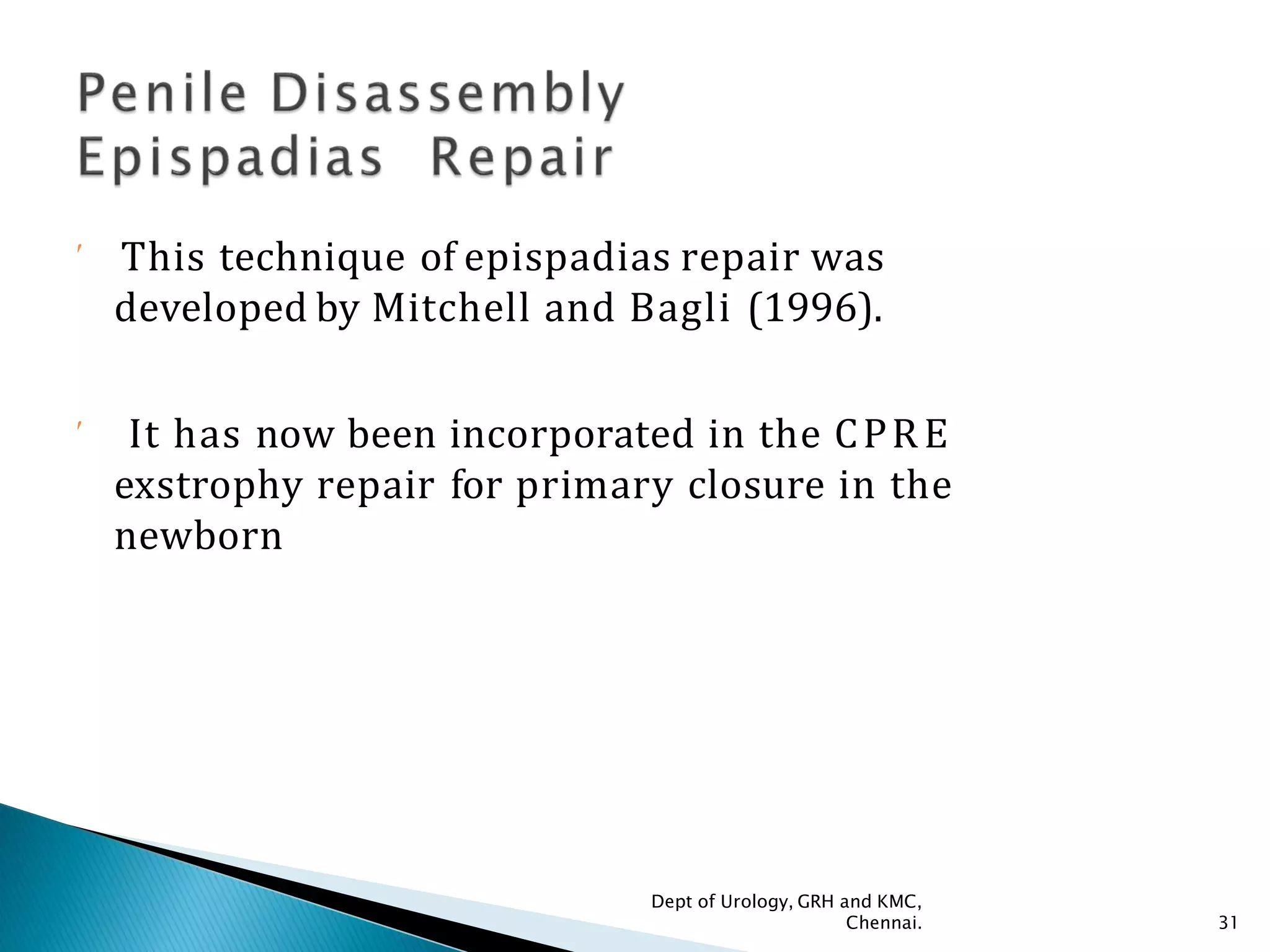 Pediatric urology:Epispadias cloacal exstrophy | PDF