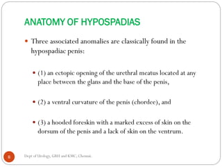 Pediatric urology:Hypospadias- etiology, embryology | PPT