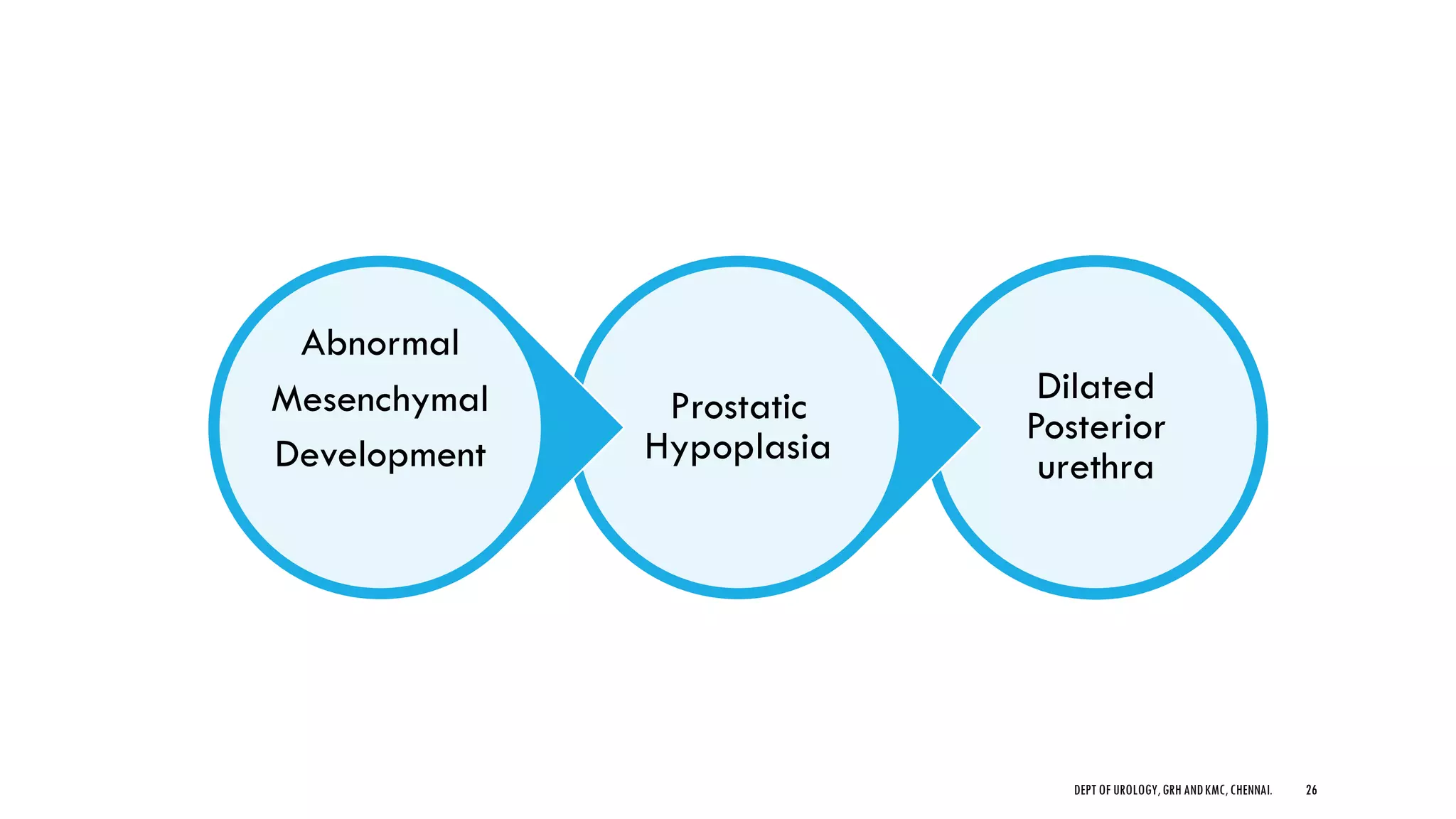 Pediatric urology:Prune Belly Syndrome(PBS) | PDF
