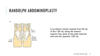 Pediatric urology:Prune Belly Syndrome(PBS) | PDF