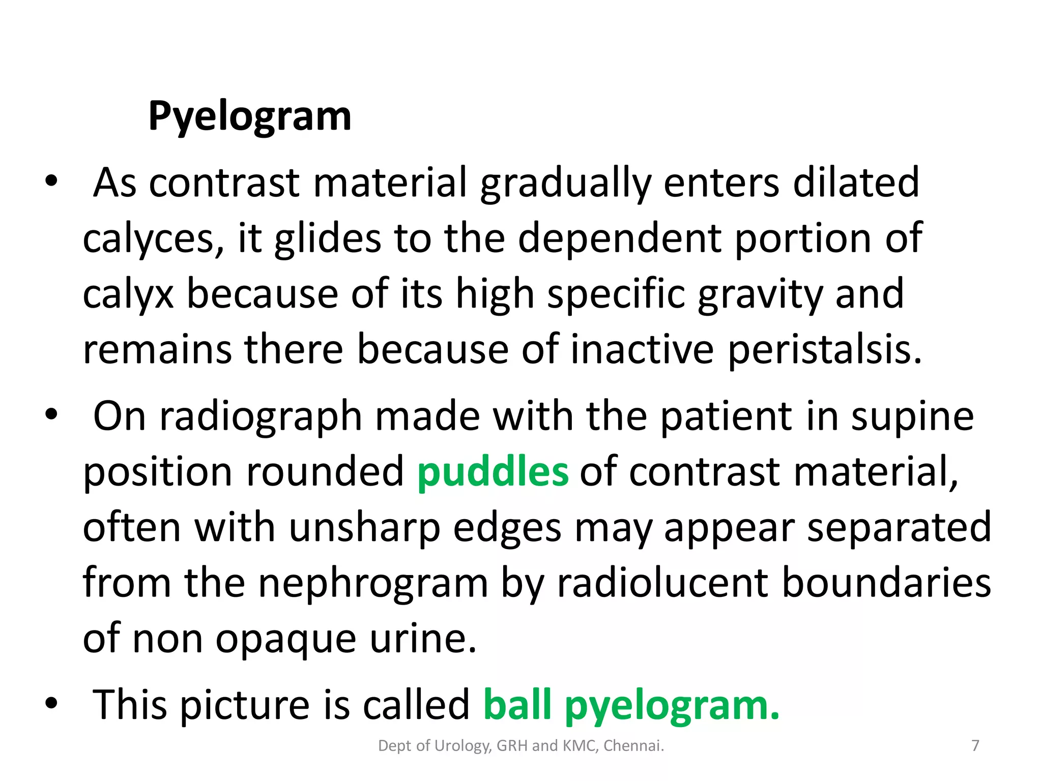 Pediatric urology:Role of ivu, usg in Pelvi-Ureteric Junction ...