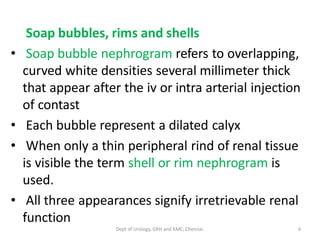 Pediatric urology:Role of ivu, usg in Pelvi-Ureteric Junction ...