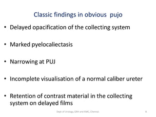Pediatric urology:Role of ivu, usg in Pelvi-Ureteric Junction ...