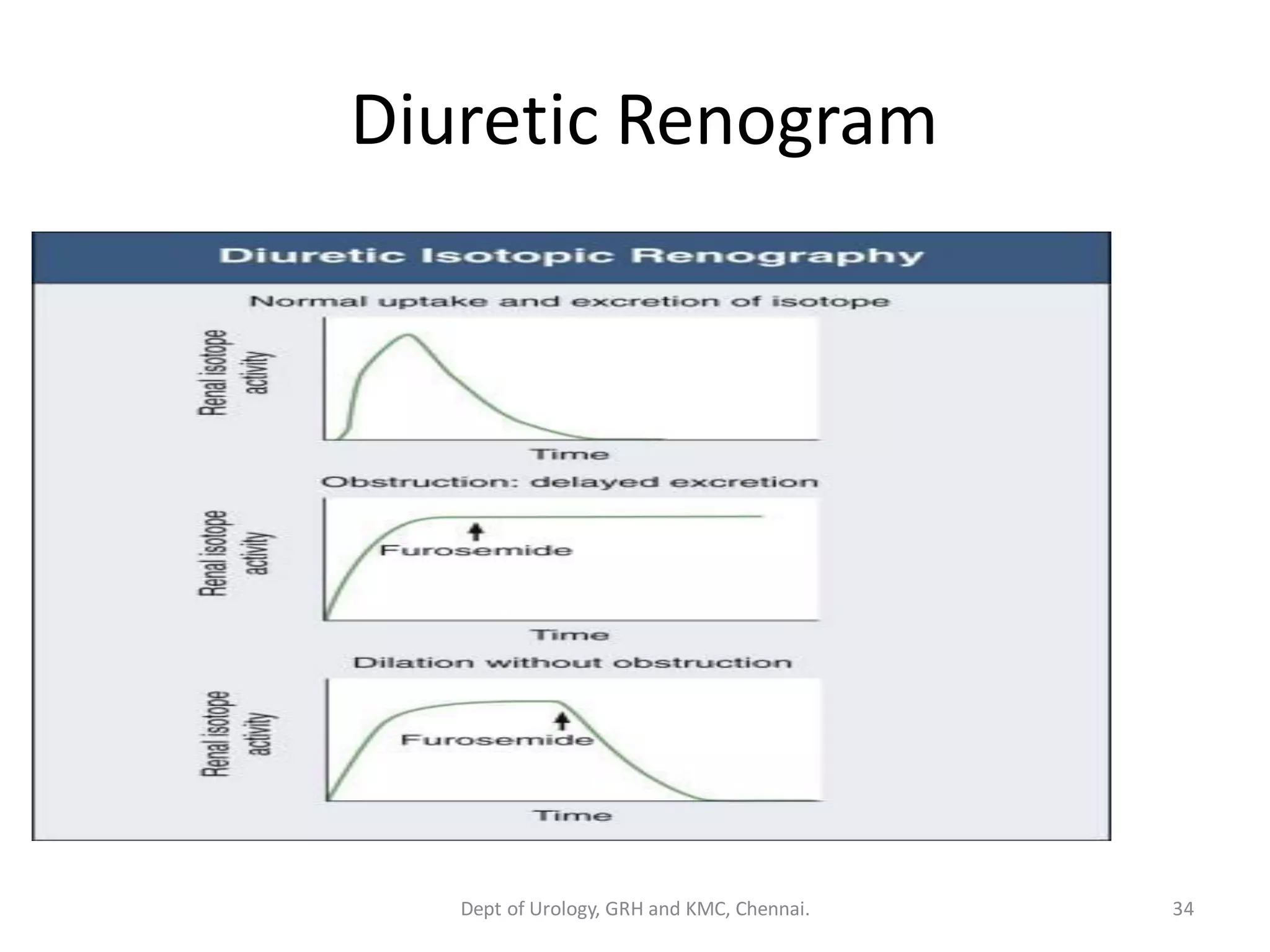 Pediatric urology pujo- pathology | PDF