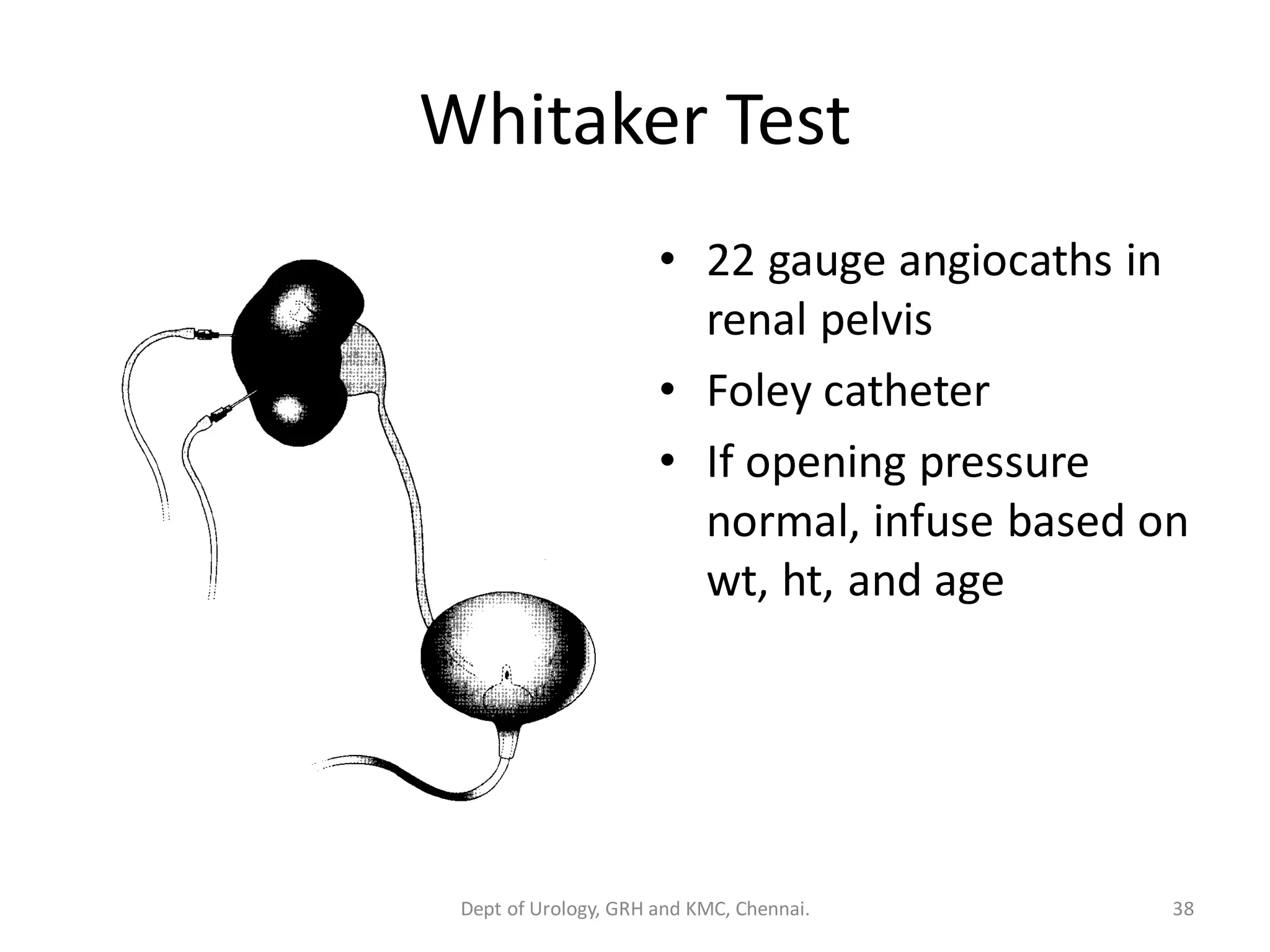 Pediatric urology pujo- pathology | PDF