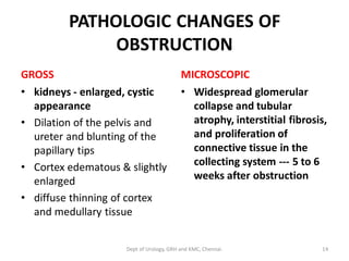 Pediatric urology pujo- pathology | PDF