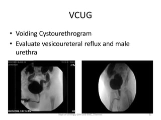 Pediatric urology pujo- pathology | PDF