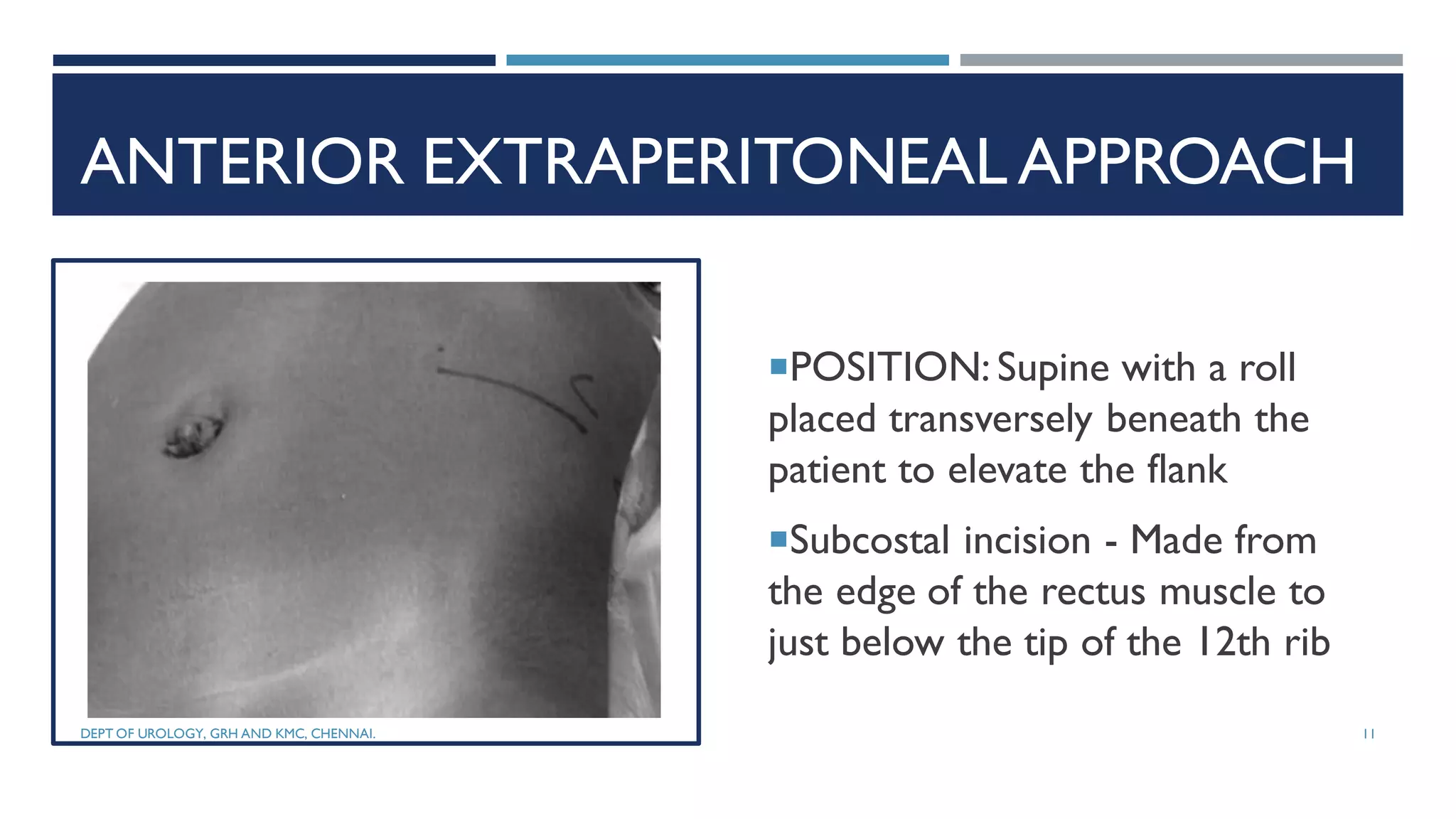 Pediatric urology pujo- pyeloplasty | PDF