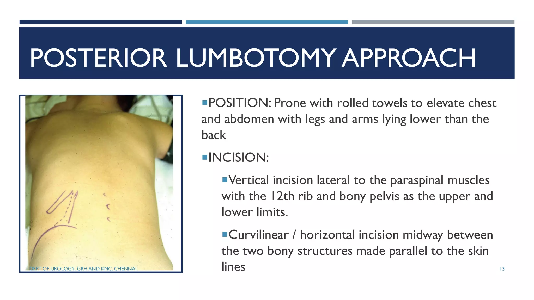 Pediatric urology pujo- pyeloplasty | PDF