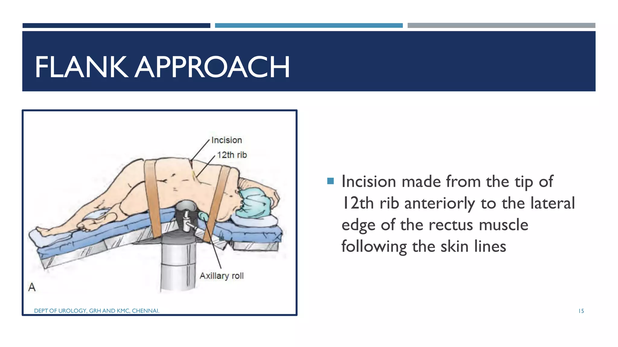 Pediatric urology pujo- pyeloplasty | PDF