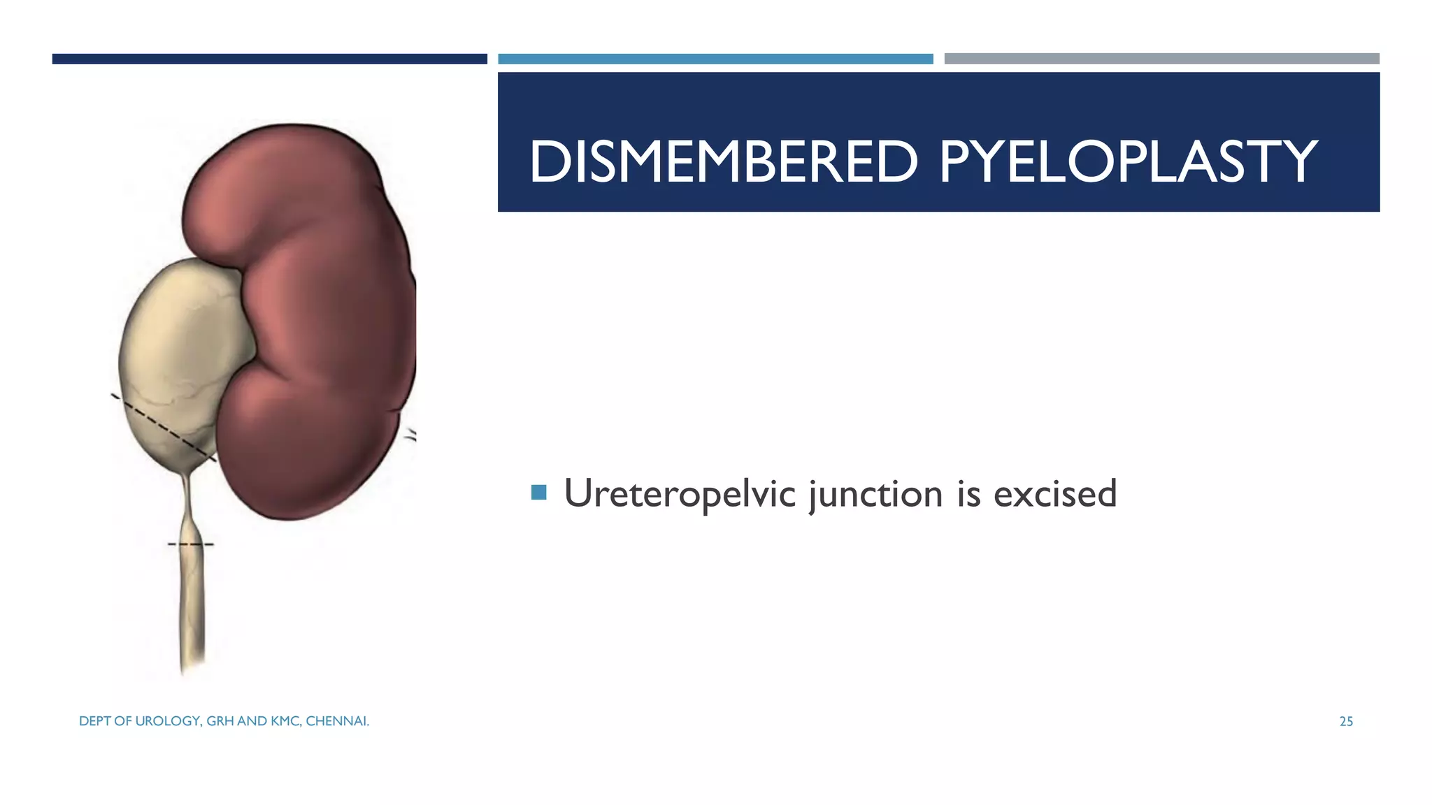 Pediatric urology pujo- pyeloplasty | PDF