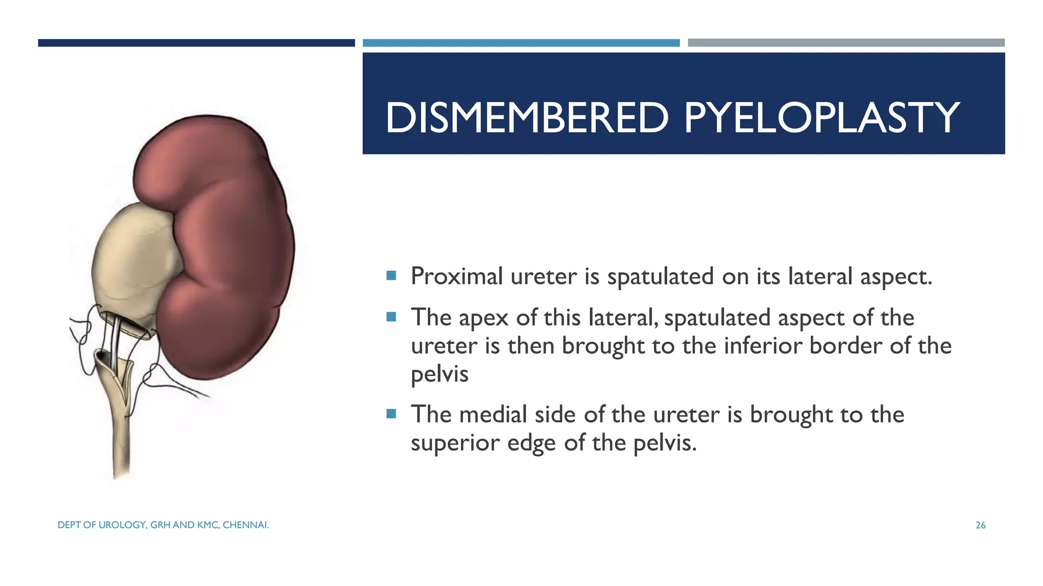 Pediatric urology pujo- pyeloplasty | PDF