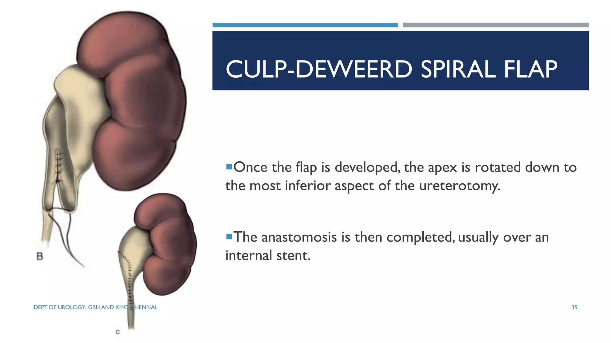 Pediatric urology pujo- pyeloplasty | PDF
