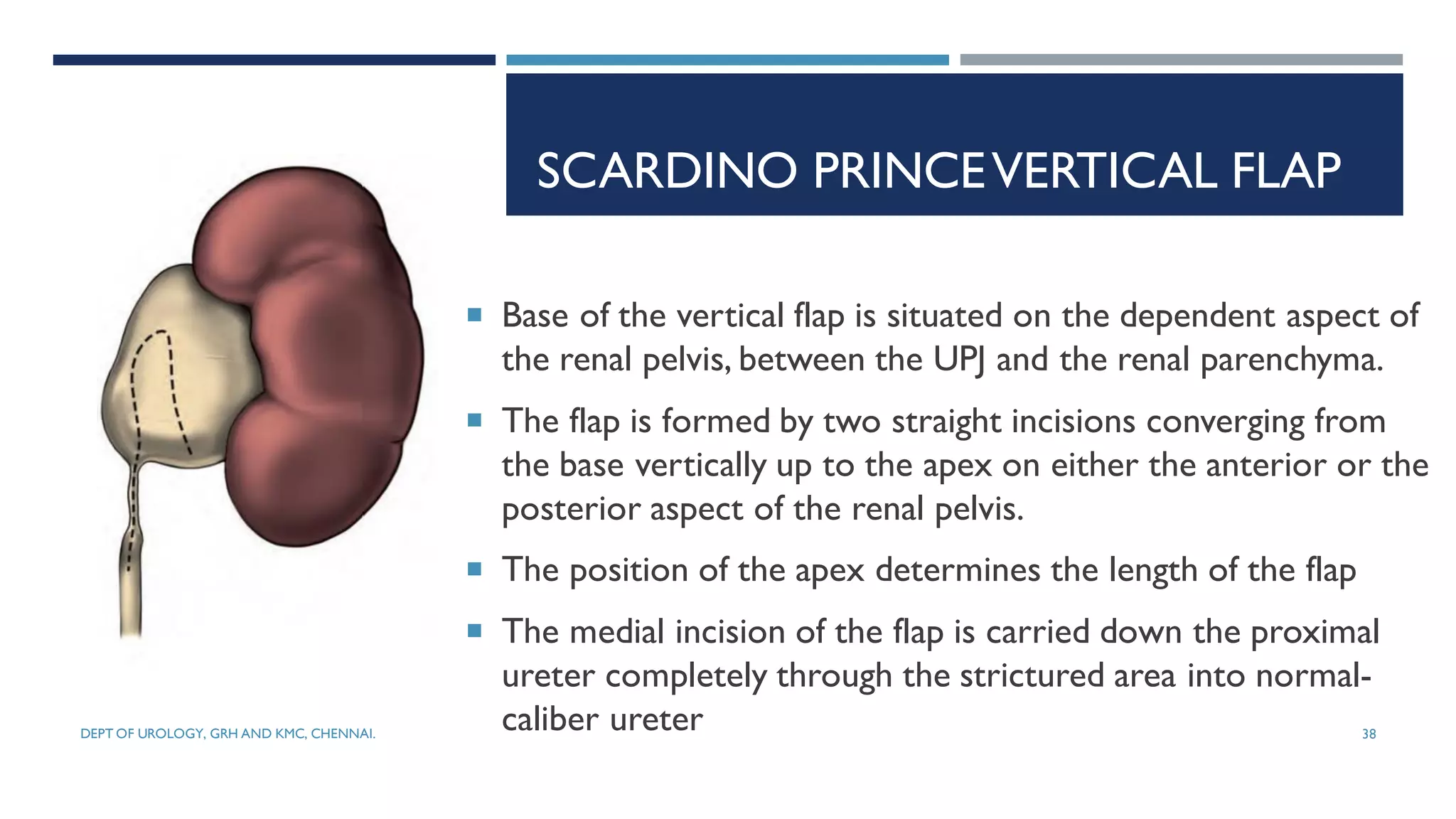 Pediatric urology pujo- pyeloplasty | PDF