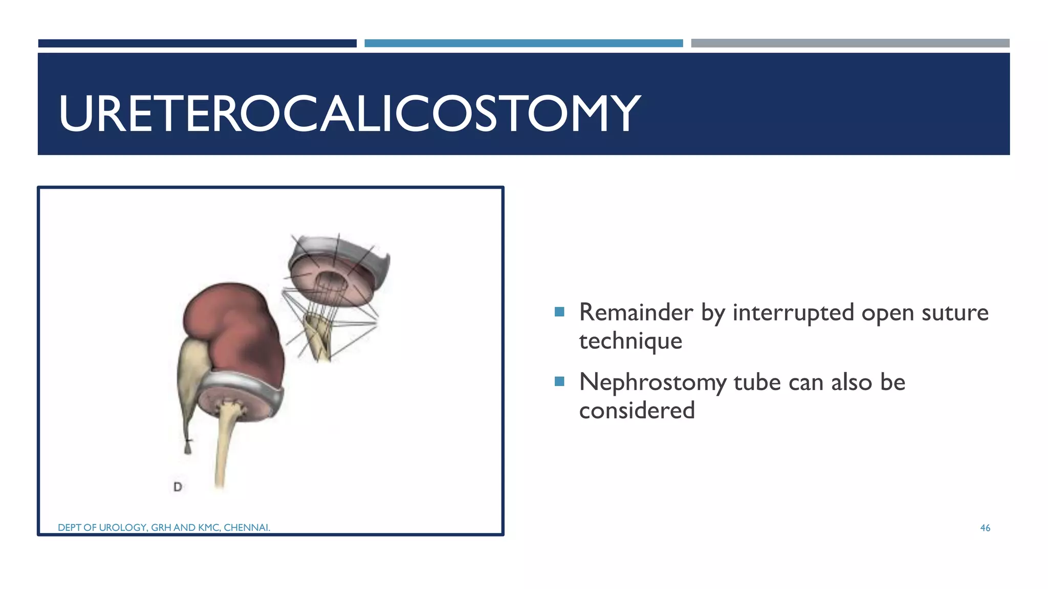 Pediatric urology pujo- pyeloplasty | PDF | Surgery | Medical Health