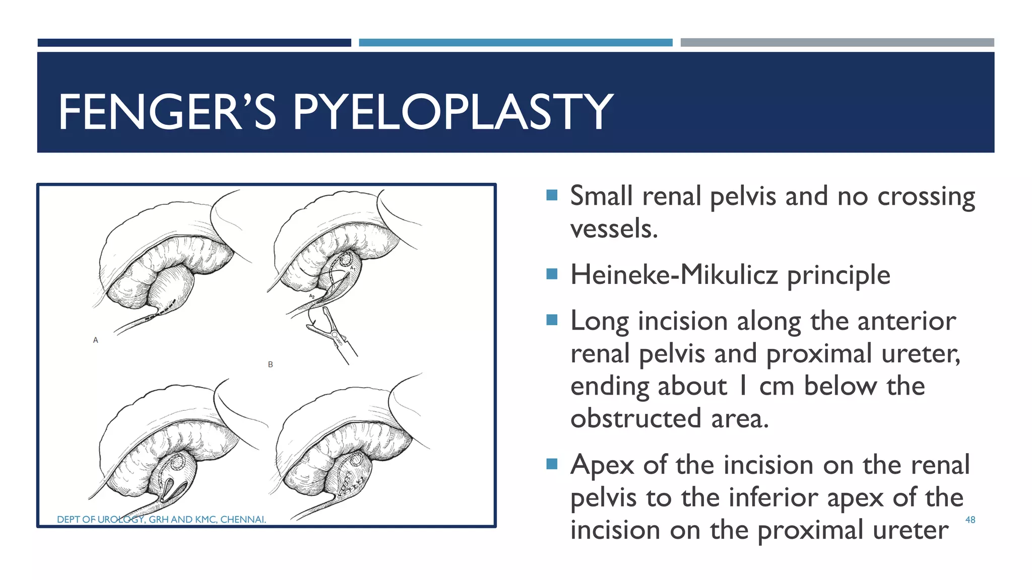 Pediatric urology pujo- pyeloplasty | PDF