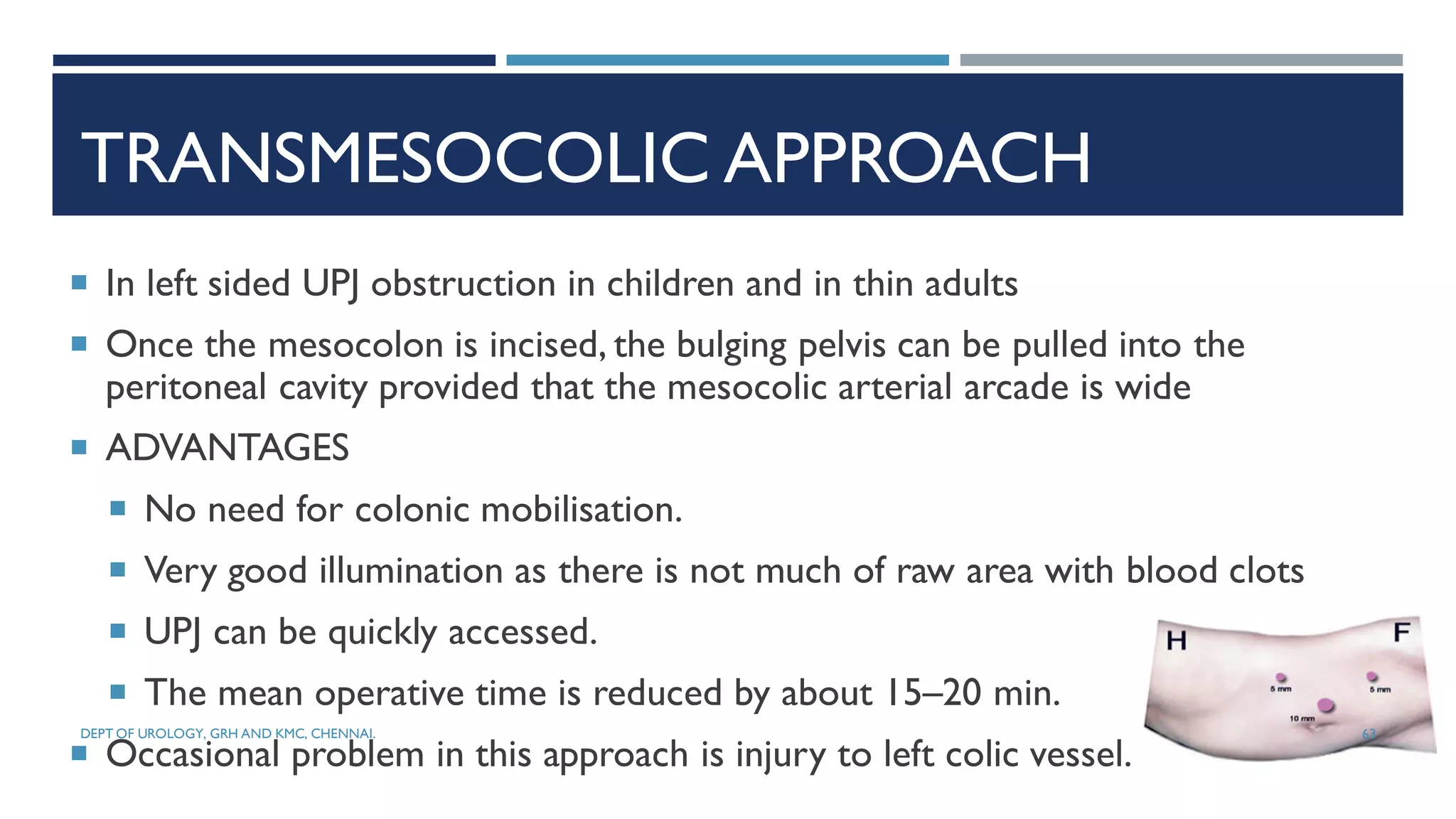 Pediatric urology pujo- pyeloplasty | PDF