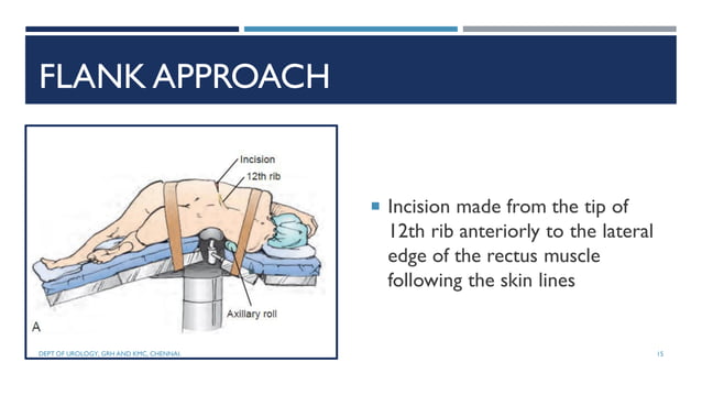Pediatric urology pujo- pyeloplasty | PDF | Surgery | Medical Health